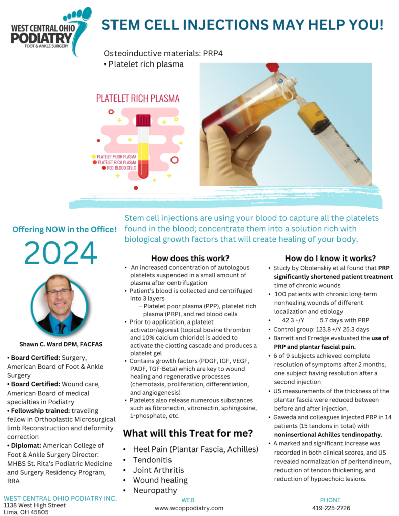 Stem Cell Injections | West Central Ohio Podiatry